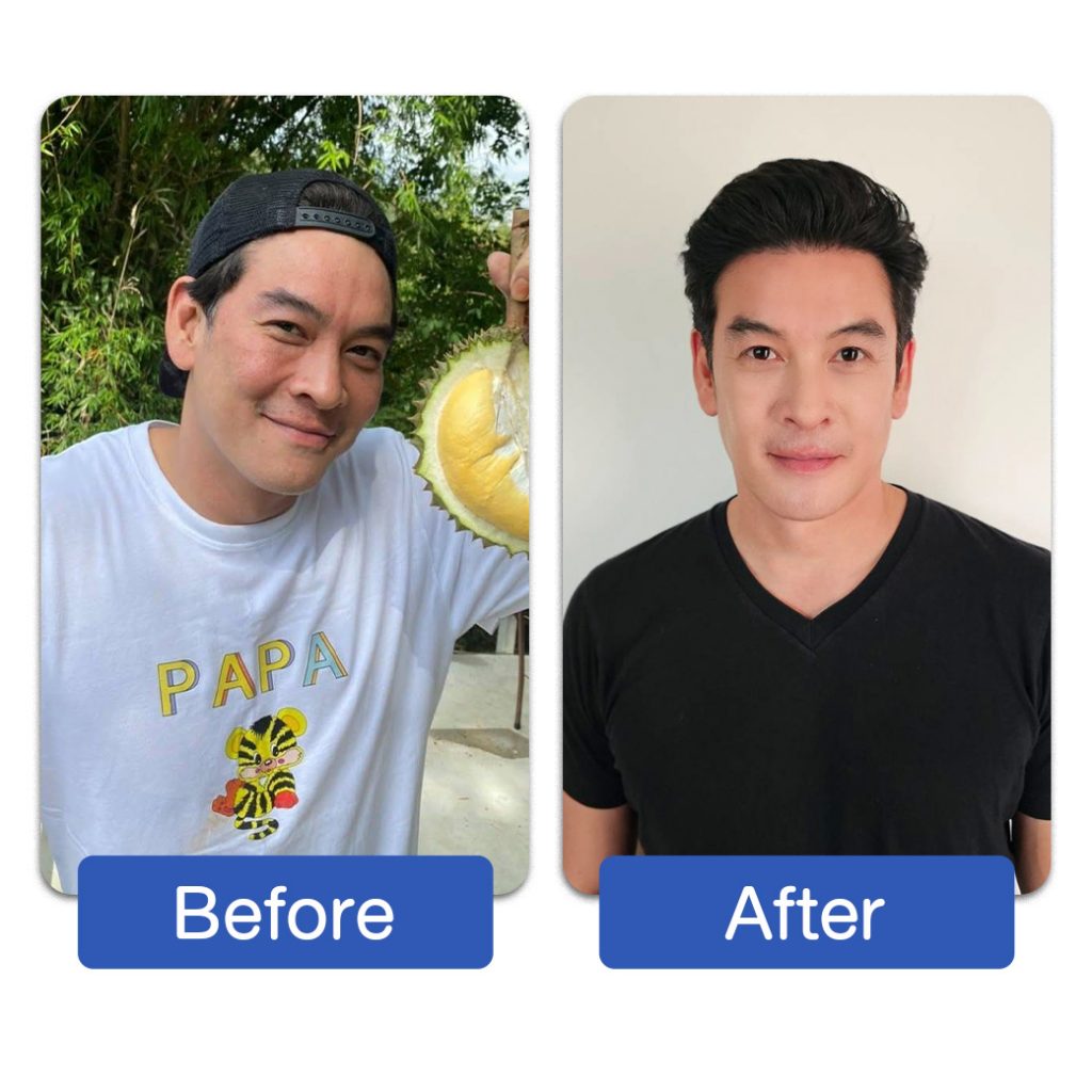 RG-DHC – Bestural X Dhc Collagen.